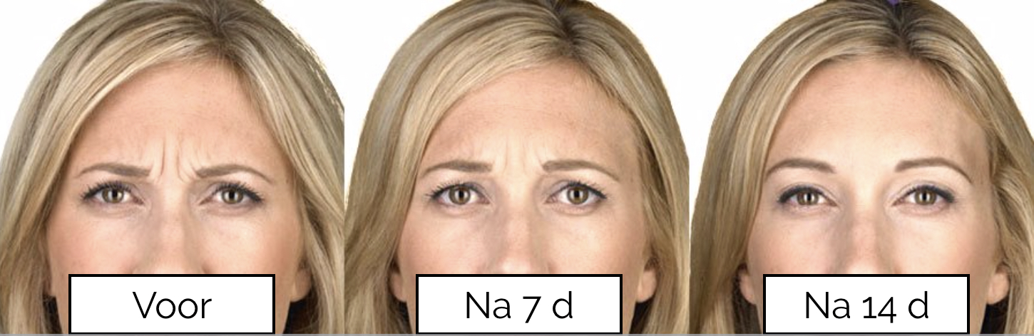 SPIERVERSLAPPERS - Dokter Guido Heijsters